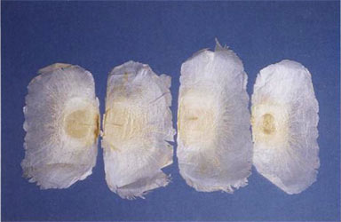 oroxylum indicum uses