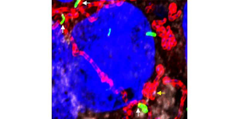 Bioengineered probiotic could prevent Listeria infections - Purdue ...